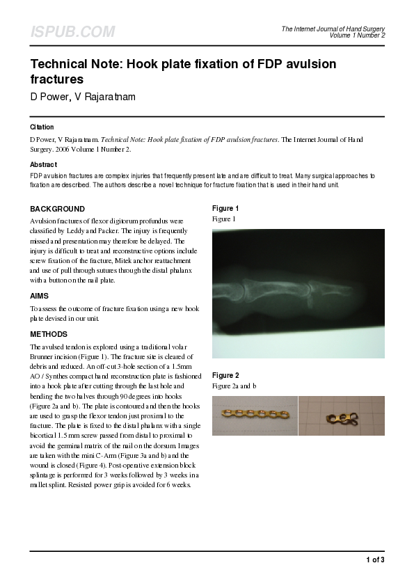 (PDF) Technical Note: Hook plate fixation of FDP avulsion fractures
