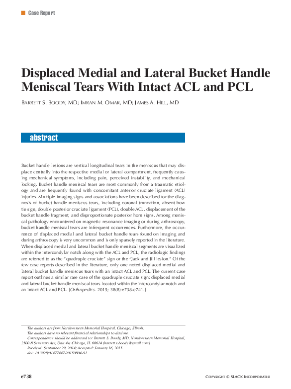 (PDF) Displaced Medial and Lateral Bucket Handle Meniscal Tears With ...
