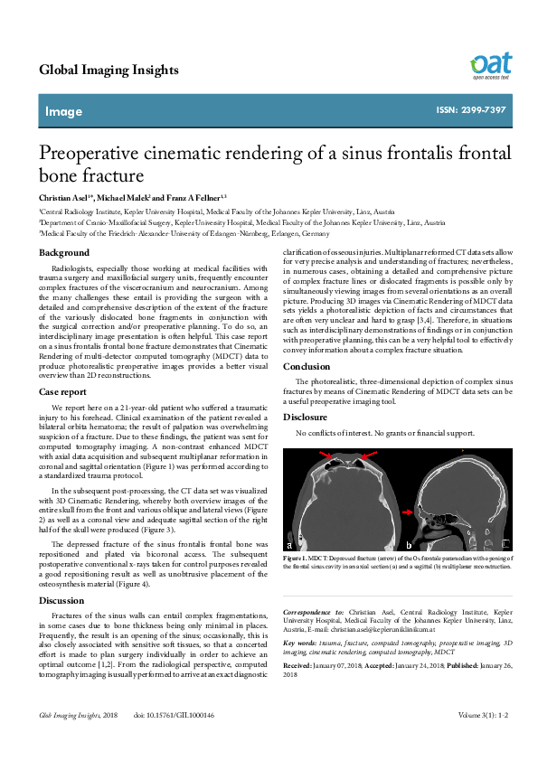 (PDF) Preoperative cinematic rendering of a sinus frontalis frontal ...