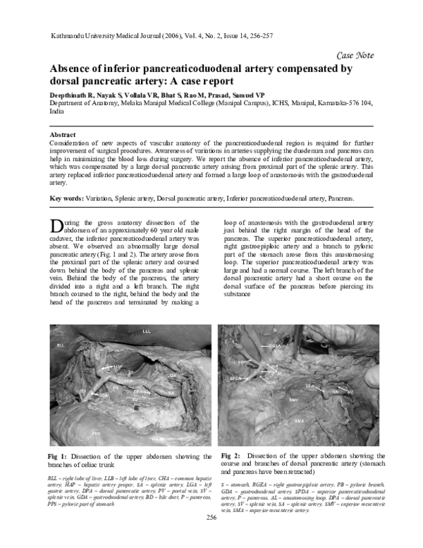 (PDF) Absence of inferior pancreaticoduodenal artery compensated by ...