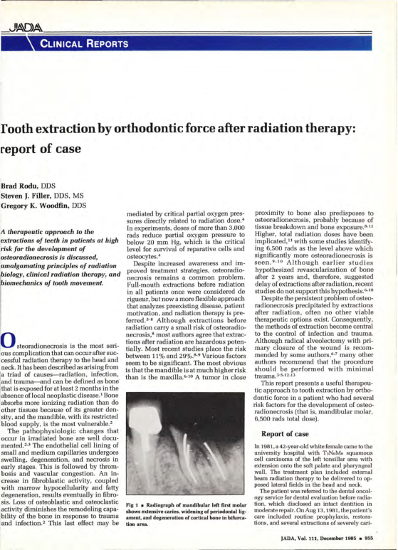 (PDF) Tooth extraction by orthodontic force after radiation therapy ...