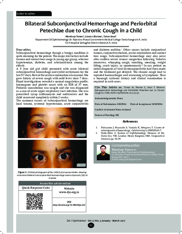 (PDF) Bilateral Subconjunctival Hemorrhage and Periorbital Petechiae ...