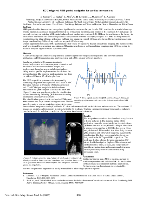 (PDF) ECG triggered MRI-guided navigation for cardiac interventions