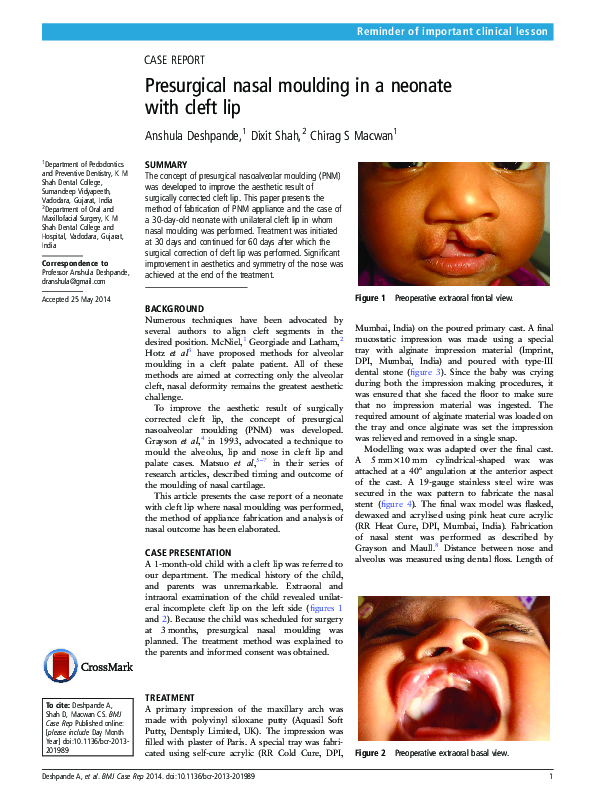 (PDF) Presurgical nasal moulding in a neonate with cleft lip