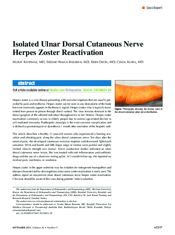 Isolated Ulnar Dorsal Cutaneous Nerve Herpes Zoster Reactivation