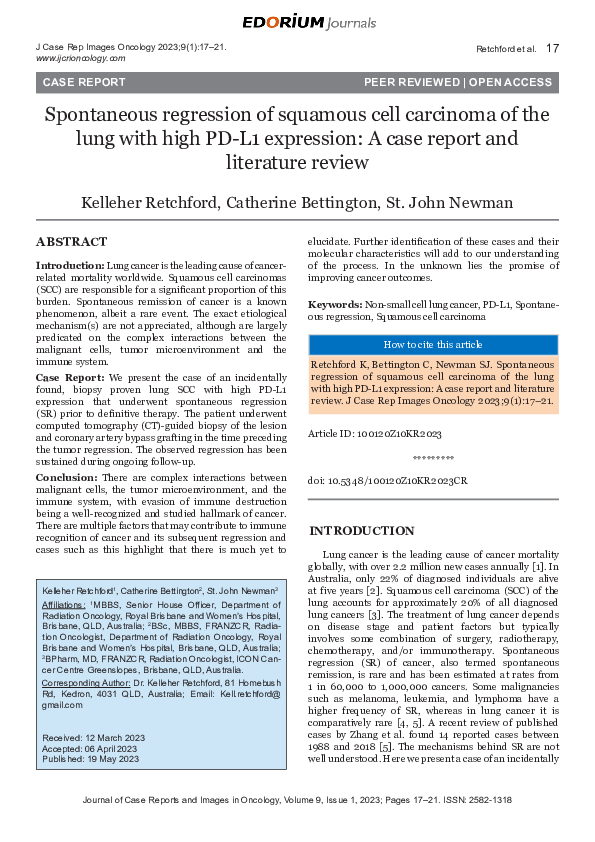 (PDF) Spontaneous regression of squamous cell carcinoma of the lung with high PD-L1 expression ...
