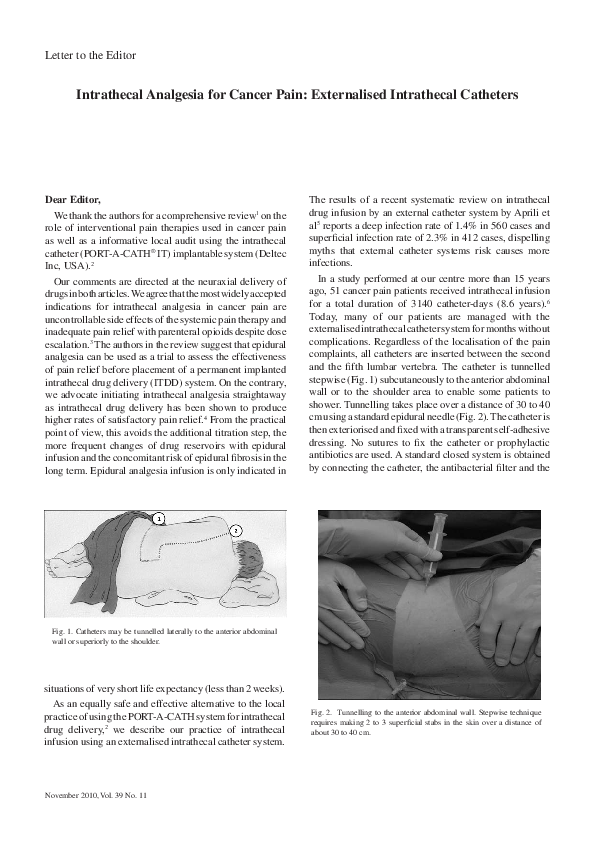 (PDF) Intrathecal Analgesia for Cancer Pain: Externalised Intrathecal ...