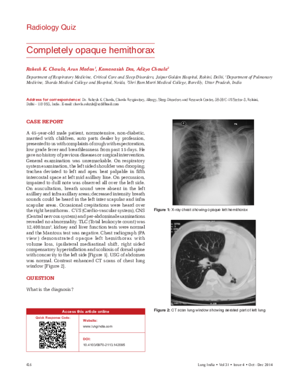 (PDF) Completely opaque hemithorax