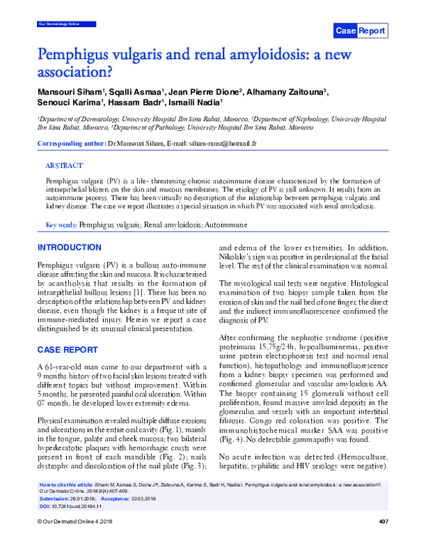 (PDF) Pemphigus vulgaris and renal amyloidosis: a new association?