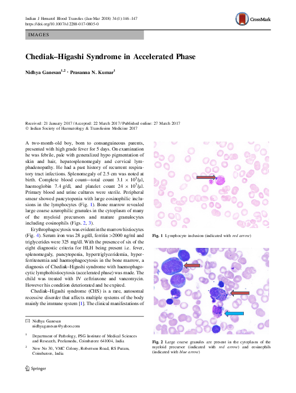 (PDF) Chediak Higashi Syndrome in the Accelerated Phase