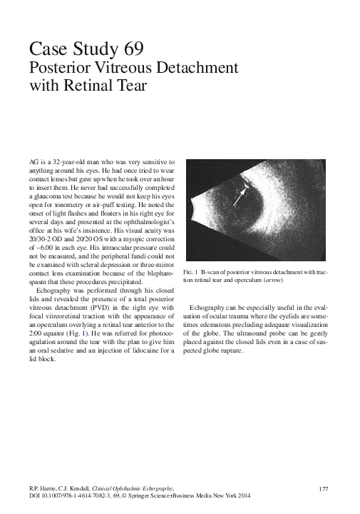 (PDF) Case Study 69 Posterior Vitreous Detachment with Retinal Tear | Roger Harrie - Academia.edu