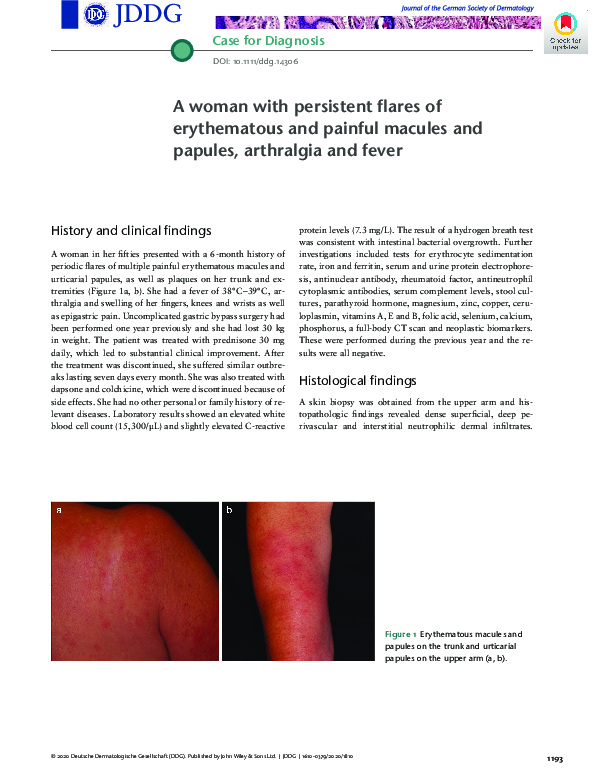 (PDF) A woman with persistent flares of erythematous and painful ...