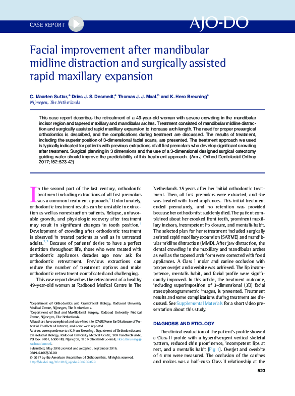 (PDF) Facial improvement after mandibular midline distraction and surgically assisted rapid ...