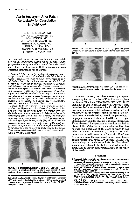 (PDF) Aortic aneurysm after patch aortoplasty for coarctation in ...