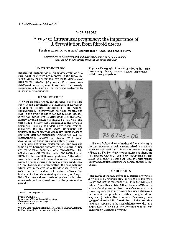 (PDF) A case of intramural pregnancy: the importance of differentiation ...