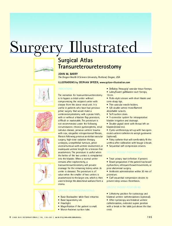 (PDF) Surgical Atlas Transureteroureterostomy