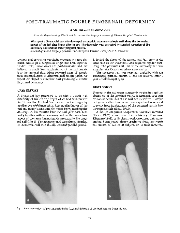 (PDF) Post-Traumatic Double Fingernail Deformity