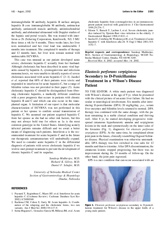 (PDF) Elastosis perforans serpiginosa secondary to D-penicillamine ...