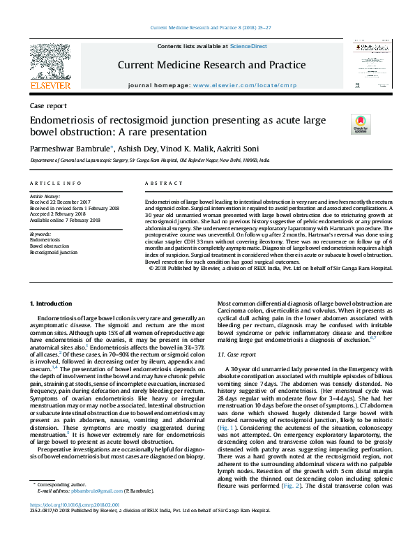 (PDF) Endometriosis of rectosigmoid junction presenting as acute large ...