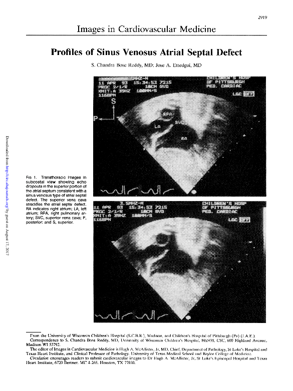 (PDF) Images in cardiovascular medicine. Profiles of sinus venosus ...