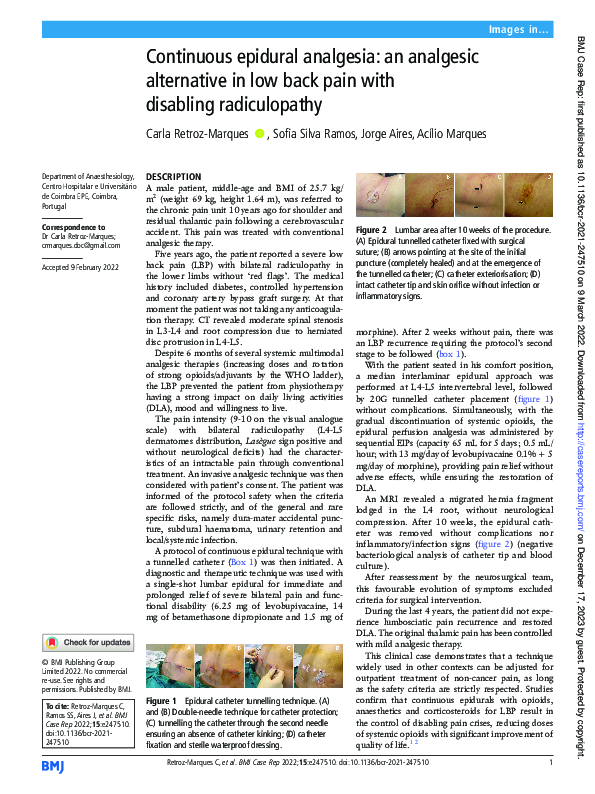 (PDF) Continuous epidural analgesia: an analgesic alternative in low ...