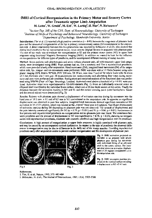 (PDF) fMRI of Cortical Reorganization in the Primary Motor and Sensory ...