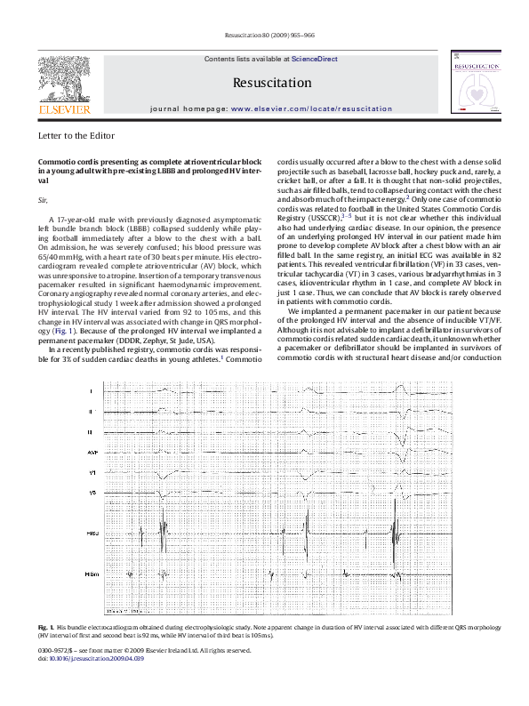 (PDF) Commotio cordis presenting as complete atrioventricular block in ...