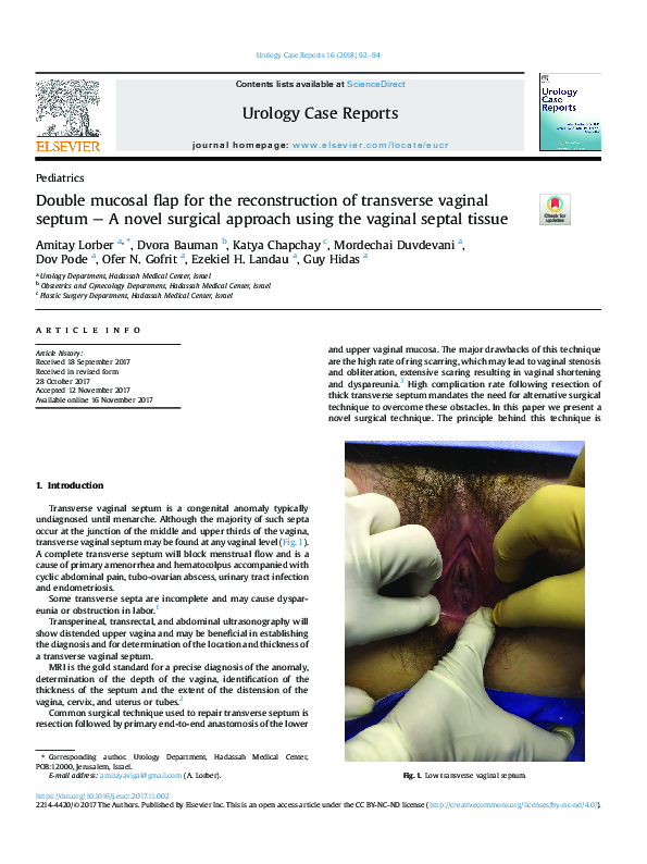 (PDF) Double mucosal flap for the reconstruction of transverse vaginal ...