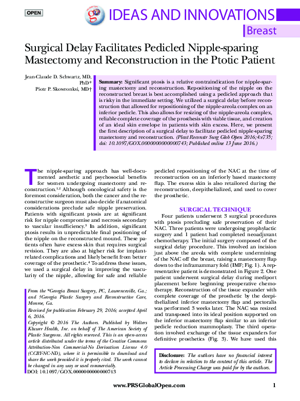 (PDF) Surgical Delay Facilitates Pedicled Nipple-sparing Mastectomy and ...
