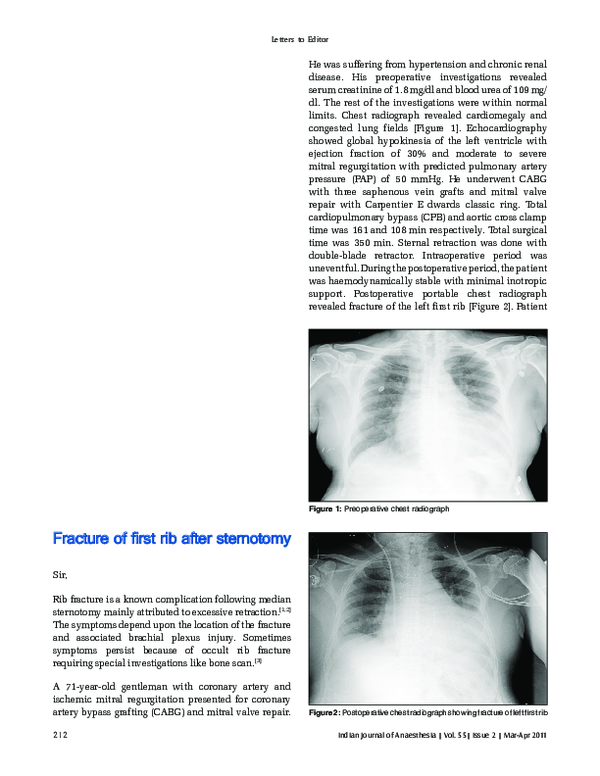 (PDF) Fracture of first rib after sternotomy