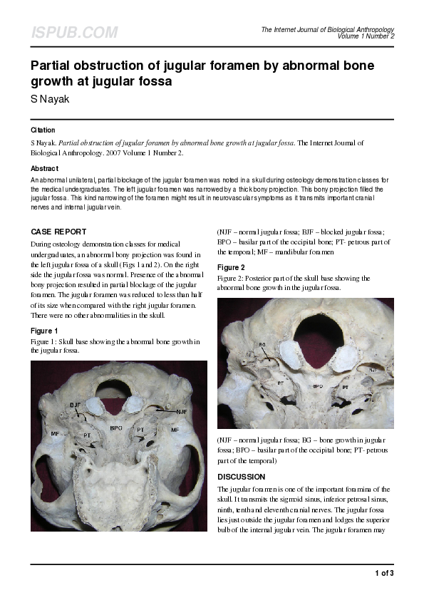 (PDF) Partial obstruction of jugular foramen by abnormal bone growth at ...