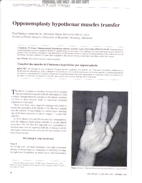 (PDF) Opponensplasty Hypothenar Muscles Transfer