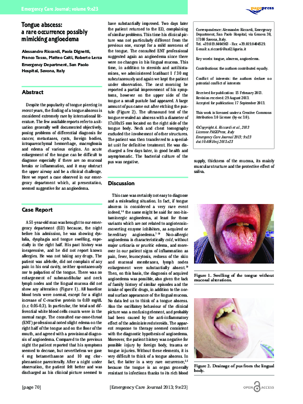 (PDF) Tongue abscess: a rare occurrence possibly mimicking angioedema