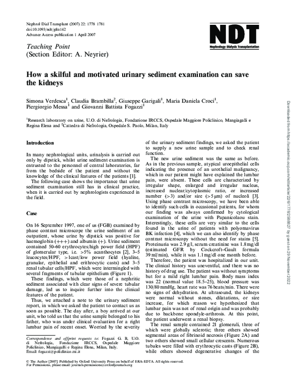 (PDF) How a skilful and motivated urinary sediment examination can save the kidneys