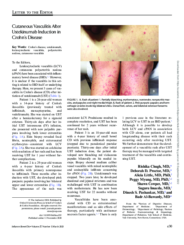 (PDF) Cutaneous Vasculitis After Ustekinumab Induction in Crohn’s Disease | Shawn Cowper ...