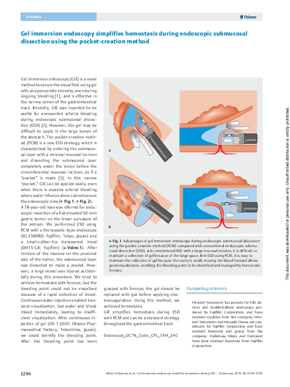 (PDF) Gel immersion endoscopy simplifies hemostasis during endoscopic submucosal dissection ...