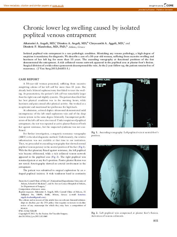 (PDF) Chronic lower leg swelling caused by isolated popliteal venous ...