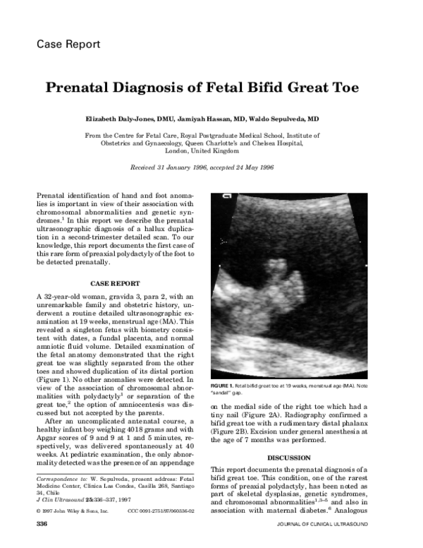 (PDF) Prenatal diagnosis of fetal bifid great toe