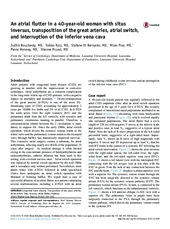 (PDF) An atrial flutter in a 40-year-old woman with situs inversus ...