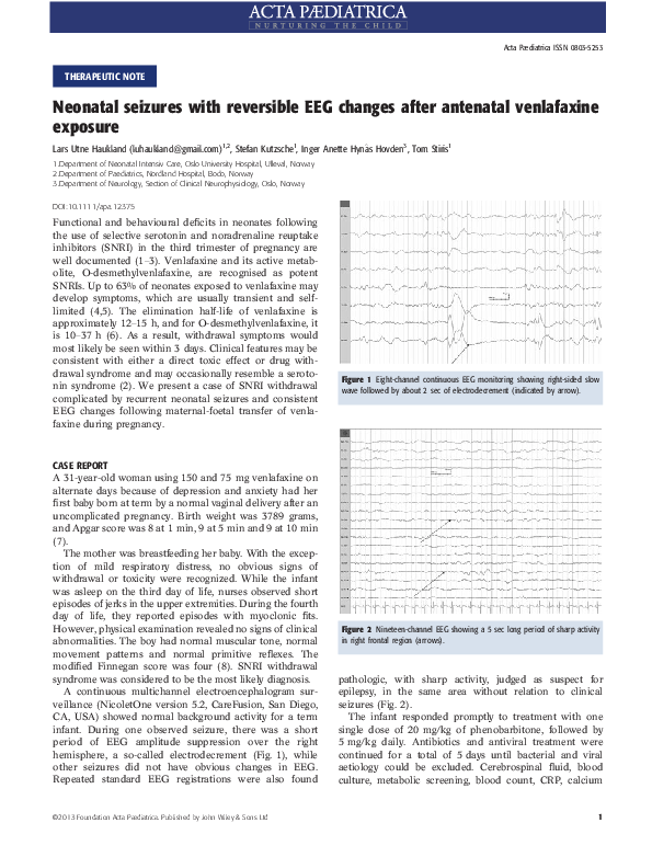 (PDF) Neonatal seizures with reversible EEG changes after antenatal ...