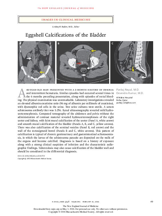 (PDF) IMAGES IN CLINICAL MEDICINE. Eggshell Calcifications of the Bladder