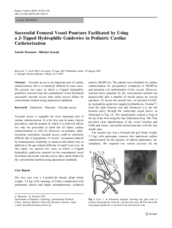 (PDF) Successful Femoral Vessel Puncture Facilitated by Using a J ...