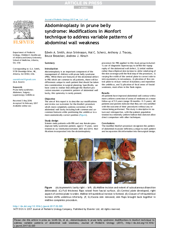 (PDF) Abdominoplasty in prune belly syndrome: Modifications in Monfort ...