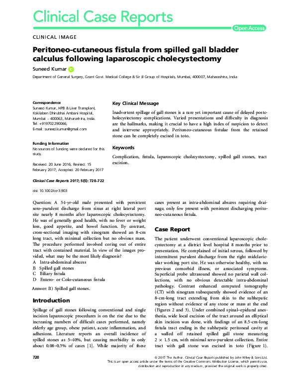 (PDF) Peritoneo-cutaneous fistula from spilled gall bladder calculus ...
