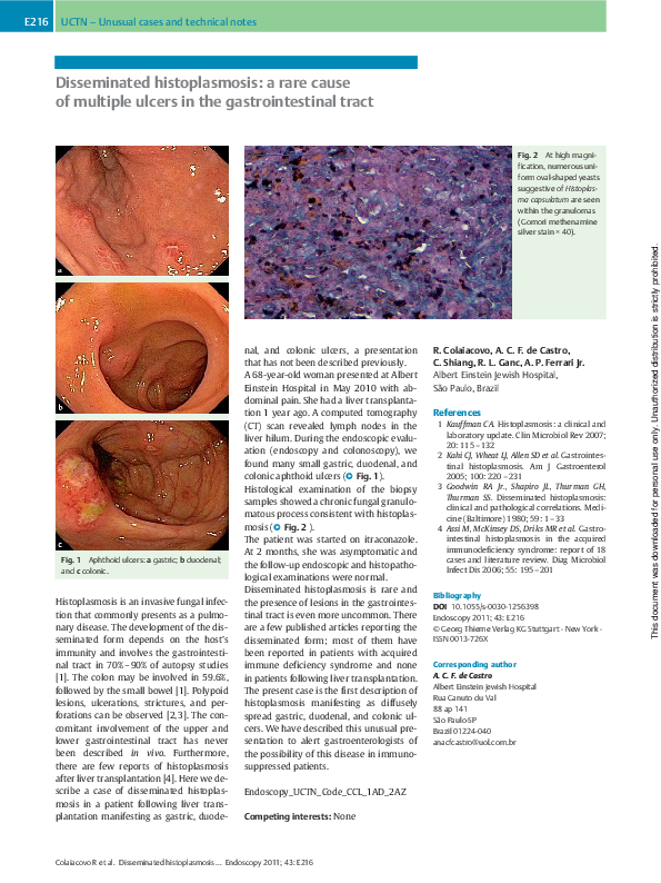 (PDF) Disseminated histoplasmosis: a rare cause of multiple ulcers in ...