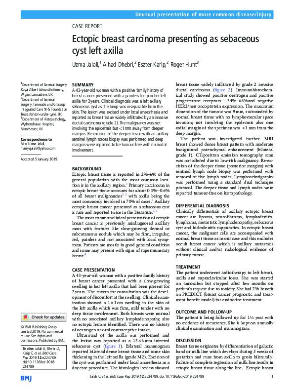 (PDF) Ectopic breast carcinoma presenting as sebaceous cyst left axilla ...