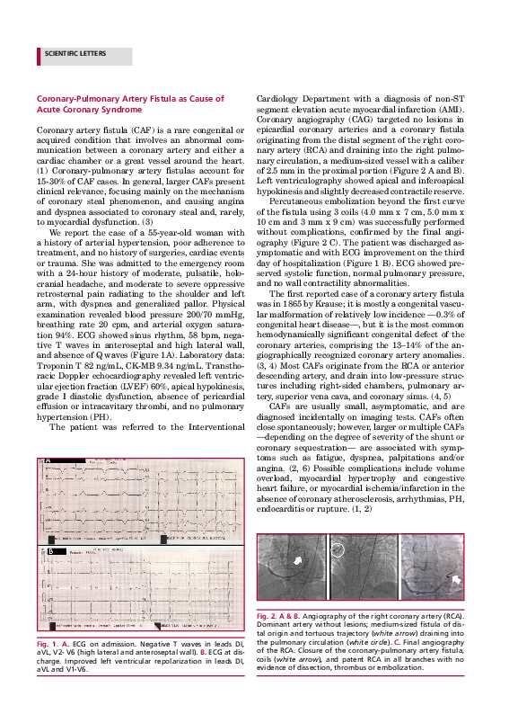 (PDF) Septostomía transeptal auricular con balón en paciente con ...