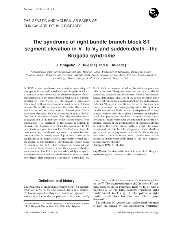 (PDF) The syndrome of right bundle branch block ST segment elevation in ...