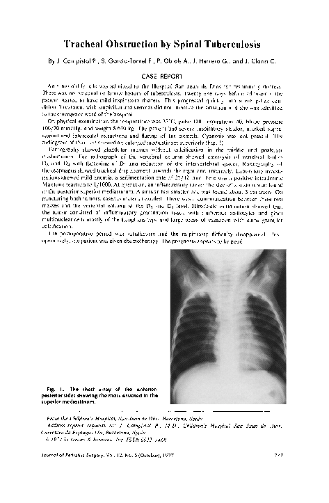 (PDF) Tracheal obstruction by spinal tuberculosis | Santiago Garcia ...