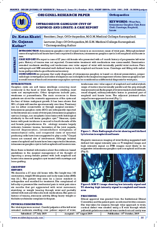 (PDF) Intraosseous Ganglion Cyst of Scaphoid and Lunate: A Case Report